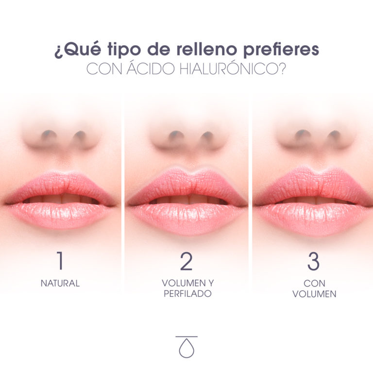 ¿CUAL ES PARA TI EL LABIO IDEAL? - Clinicas Comyce